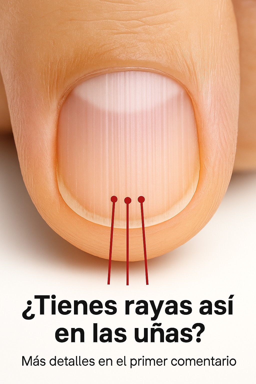LAS UÑAS: VENTANAS DE SALUD Y TRADICIÓN. REMEDIOS NATURALES Y ...