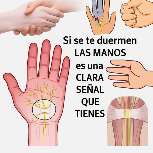 ADORMECIMIENTO DE MANOS: CUÁNDO PREOCUPARSE Y CÓMO ALIVIARLO DE FORMA ...